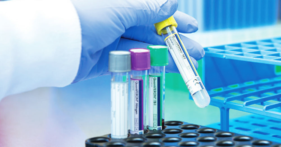 QuantiFERON Gold vs T-SPOT: IGRA TB Testing | NMS Health